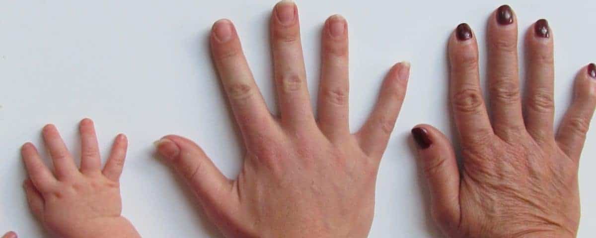 Onicofagia: hábito de roer as unhas - Dra. Juliana Toma