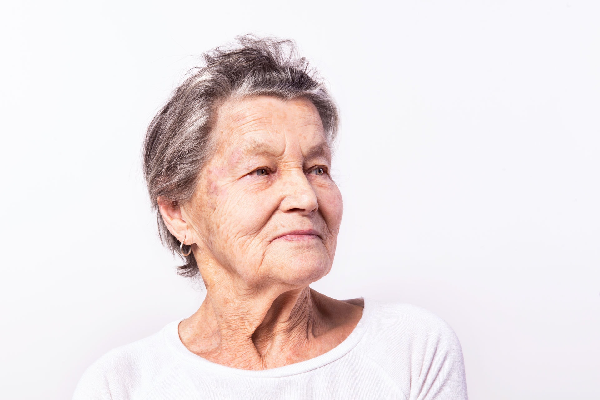 Melanoma: Causas, Sintomas e Tratamento - Clínica Dra. Juliana Toma Melanoma: Causas, Sintomas e Tratamento - Clínica Dra. Juliana Toma