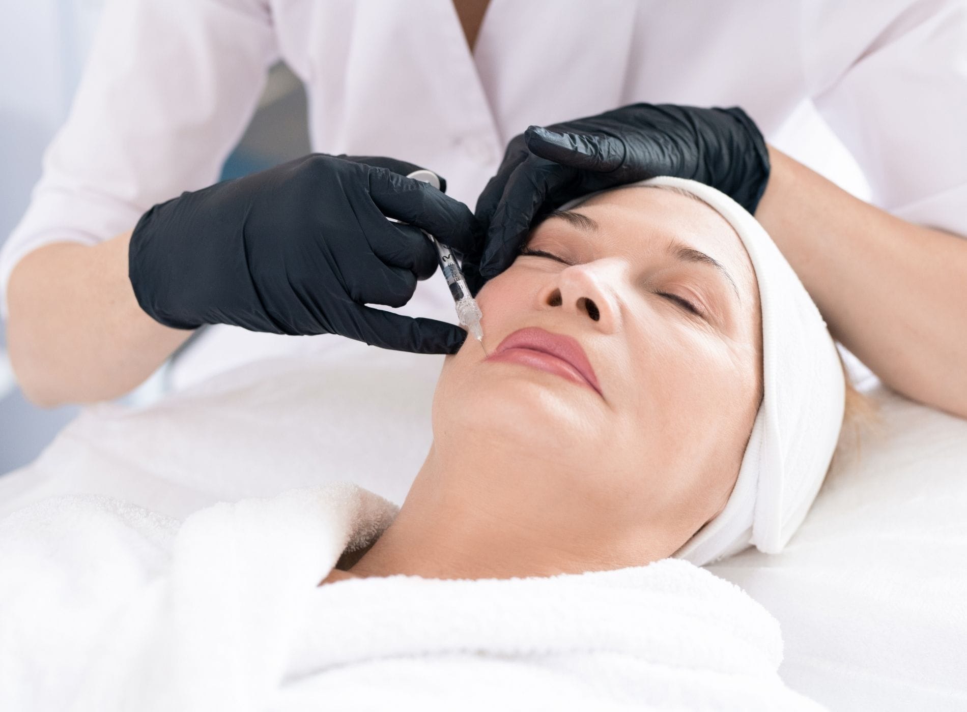 O que é o bigode chinês e como tratar - Clínica Dra. Juliana Toma