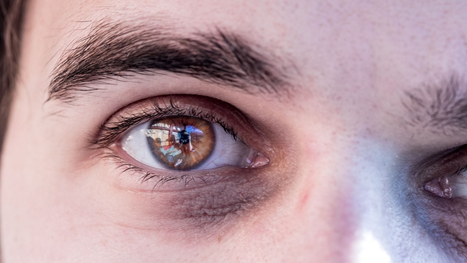 Como Funciona O Peeling Para Olheiras Dra Juliana Toma