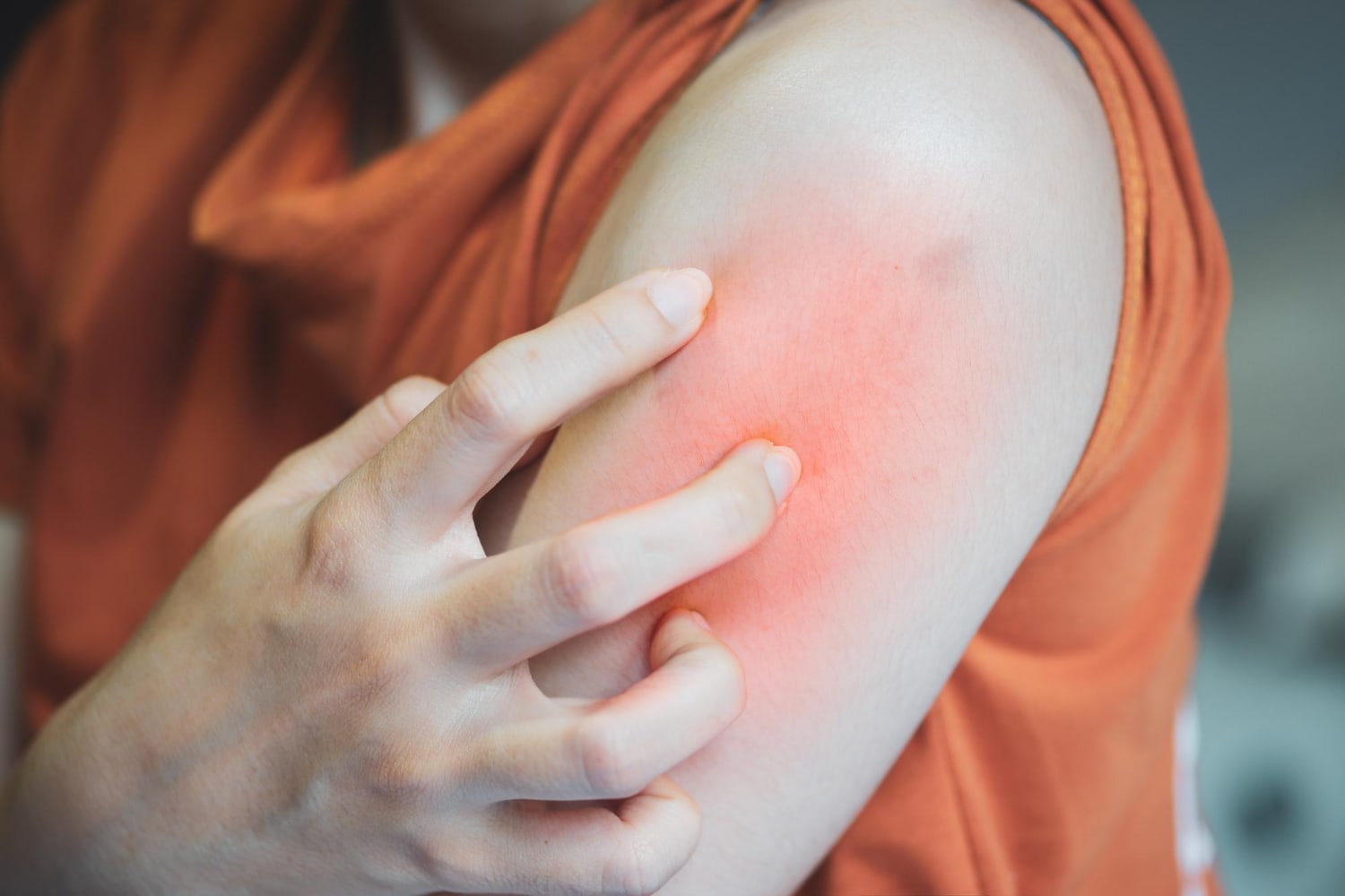 Alergia a Poliéster - Causas, Sintomas e Tratamentos - Dra. Juliana Toma