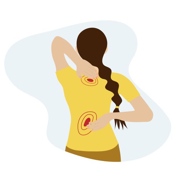 Notalgia Parestésica - Dra. Juliana Toma